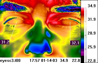 Thermology - Study of Heat with Infrared Thermal Imaging for Non ...